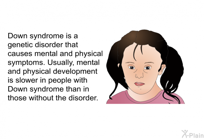 Down Syndrome Symptoms