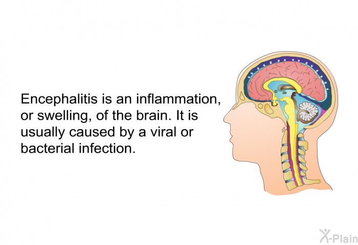 PatEdu.com : Encephalitis