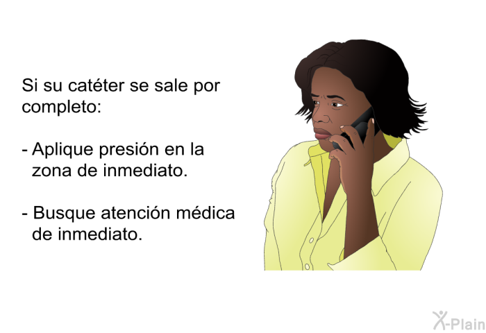 PatEdu.com : Acceso por catéter para hemodiálisis